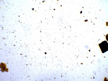 Entamoeba coli – Cyst – Parasitology