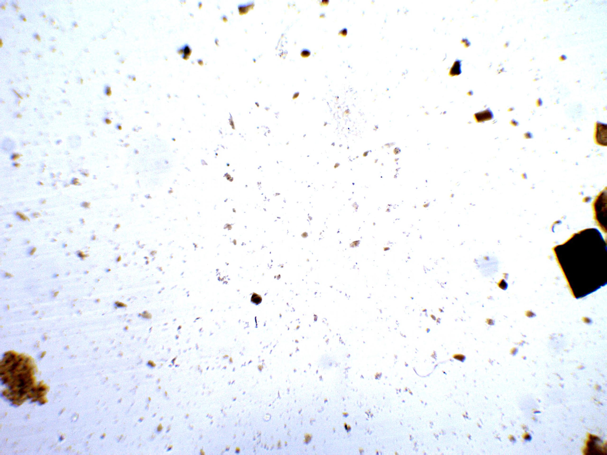 Entamoeba coli – Cyst – Parasitology