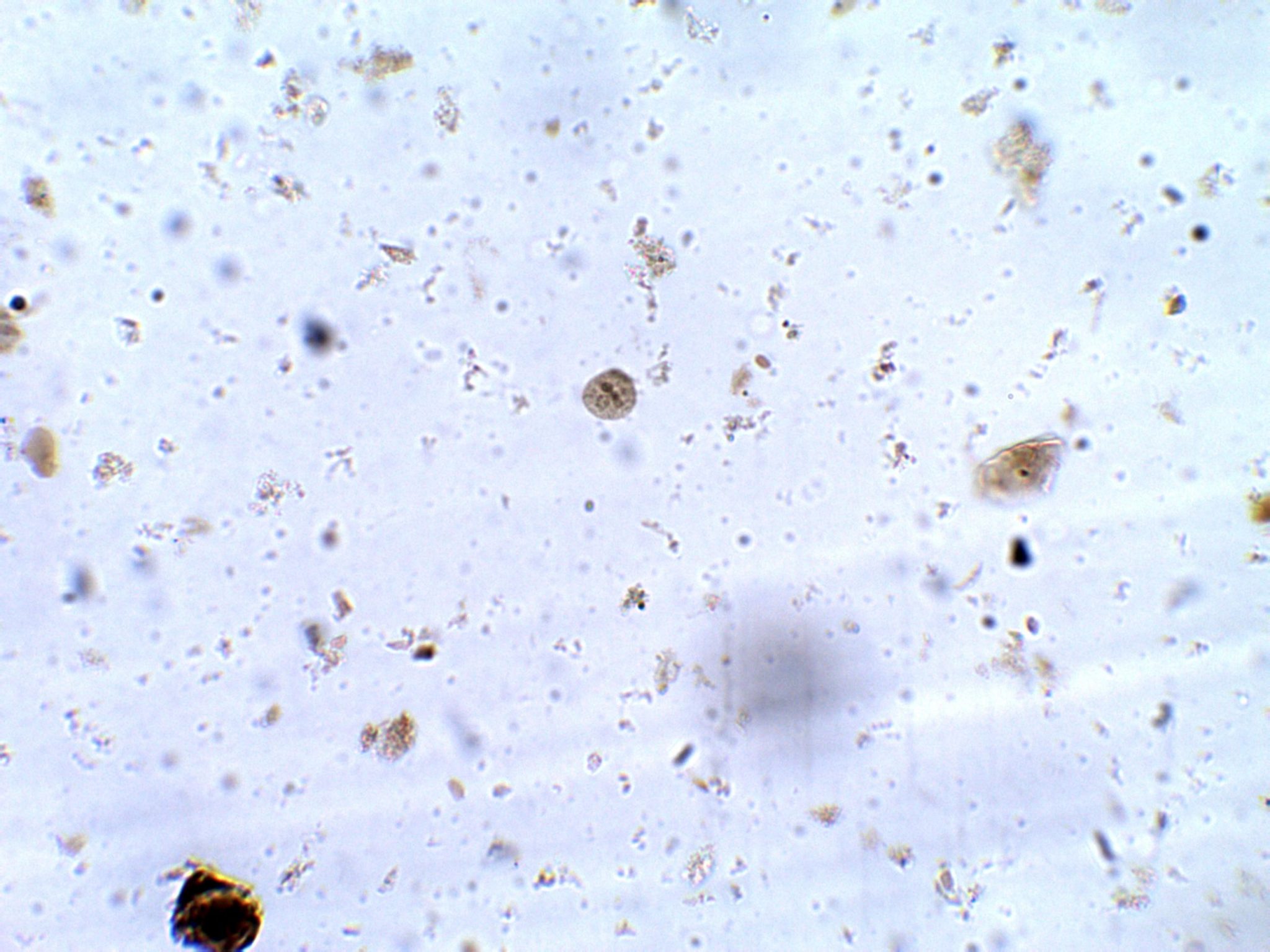 Entamoeba coli – Cyst – Parasitology