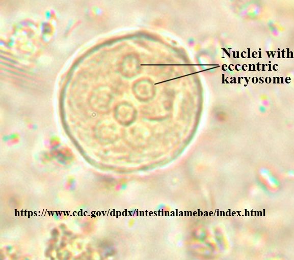 Entamoeba coli – Cyst – Parasitology