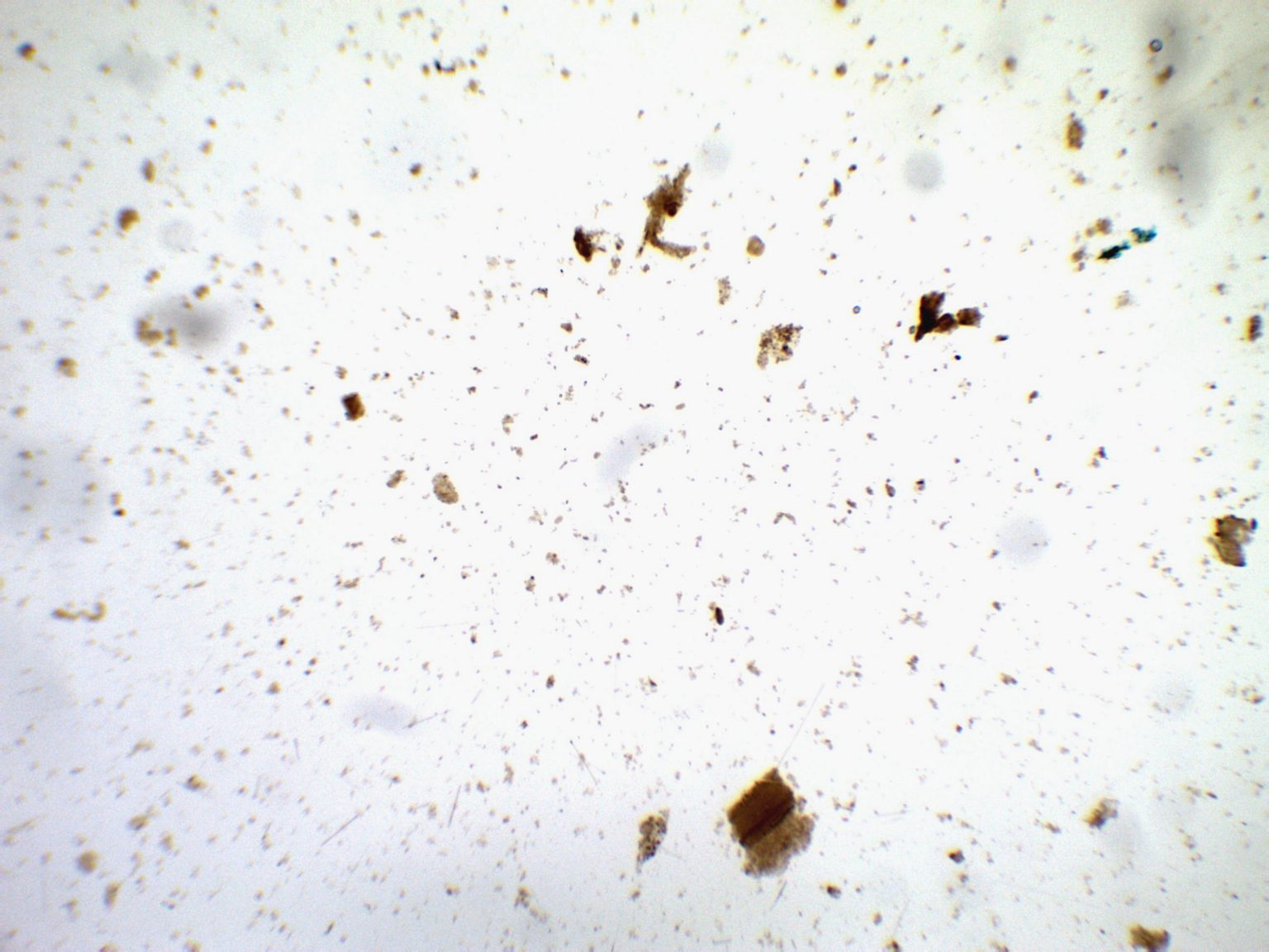 Giardia lamblia – Cyst – Parasitology