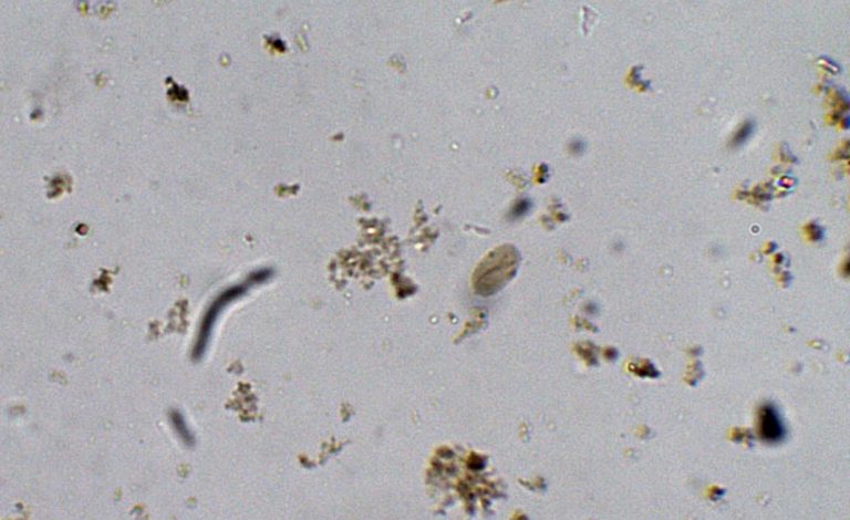 Giardia lamblia – Cyst – Parasitology