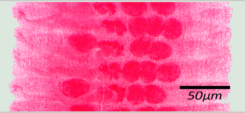 Hymenolepis nana – Proglottides – Parasitology