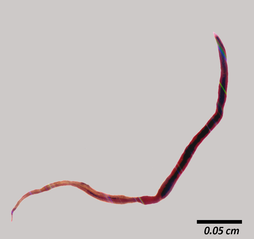 Schistosoma . species (Blood Fluke) – Adult – Parasitology