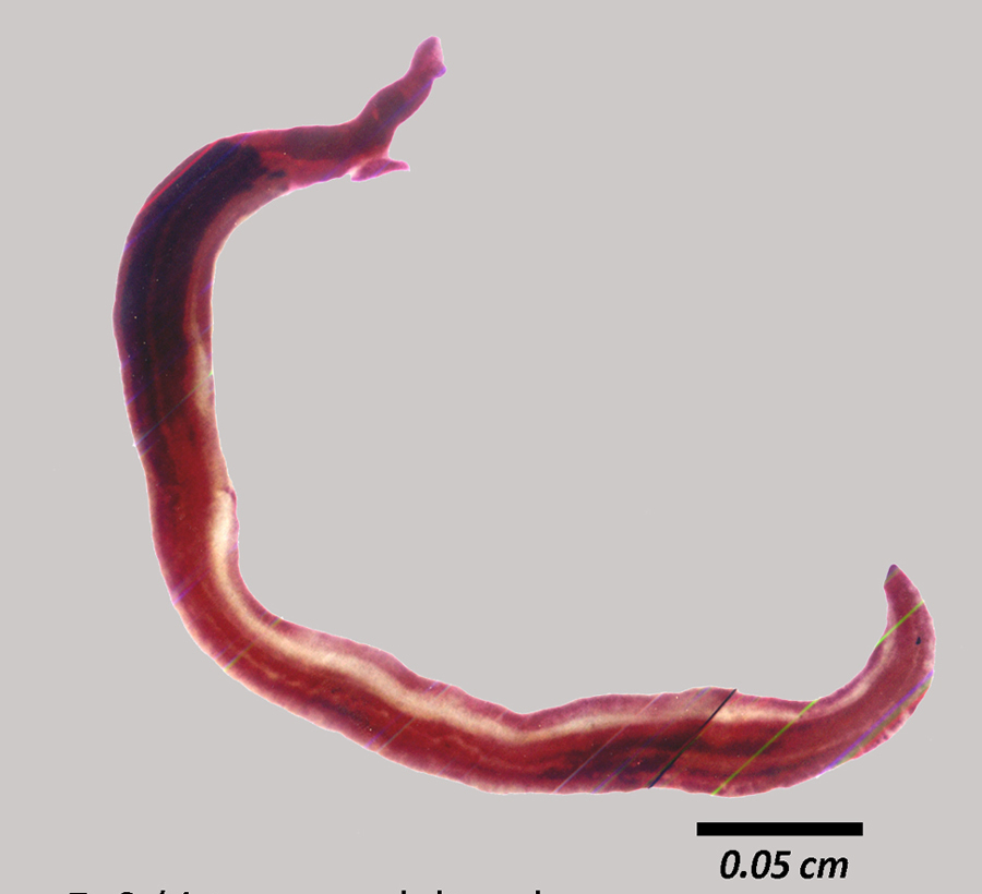 Schistosoma . species (Blood Fluke) – Adult – Parasitology