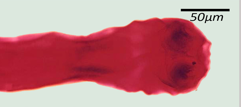 Taenia Saginata Beef Tapeworm Parasitology