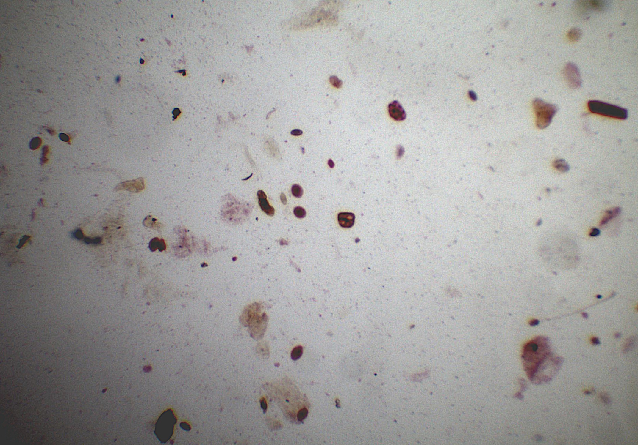 Balantidium coli – Cyst – Parasitology