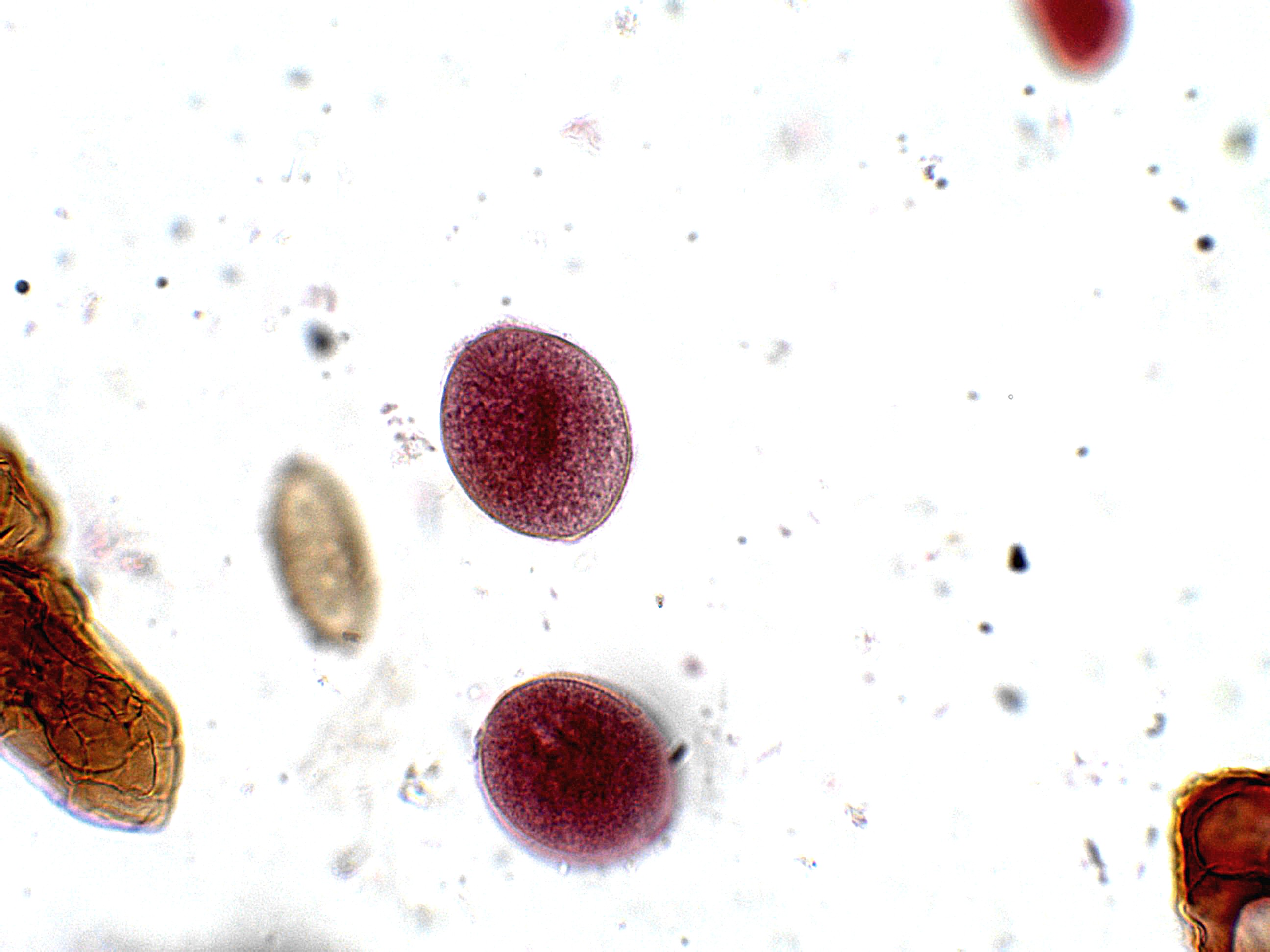 Balantidium coli – Cyst – Parasitology