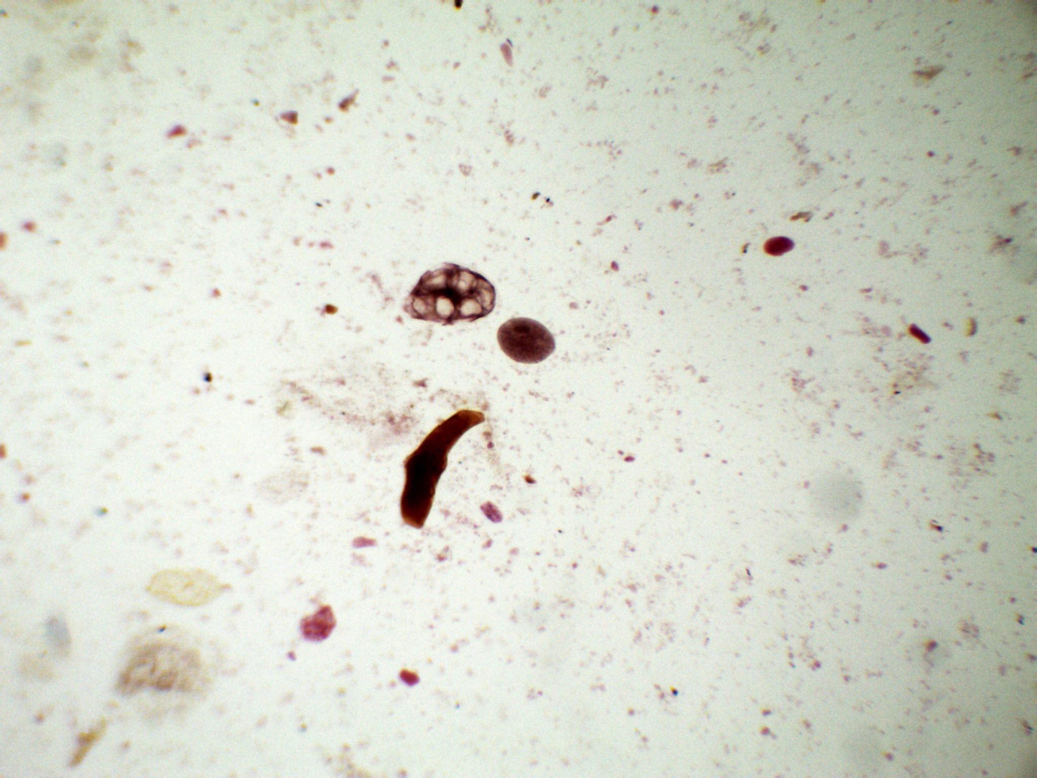 Balantidium Coli Trophozoite Parasitology