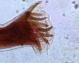 Ancylostoma duodenale – Copulatory Bursa of Male – Parasitology