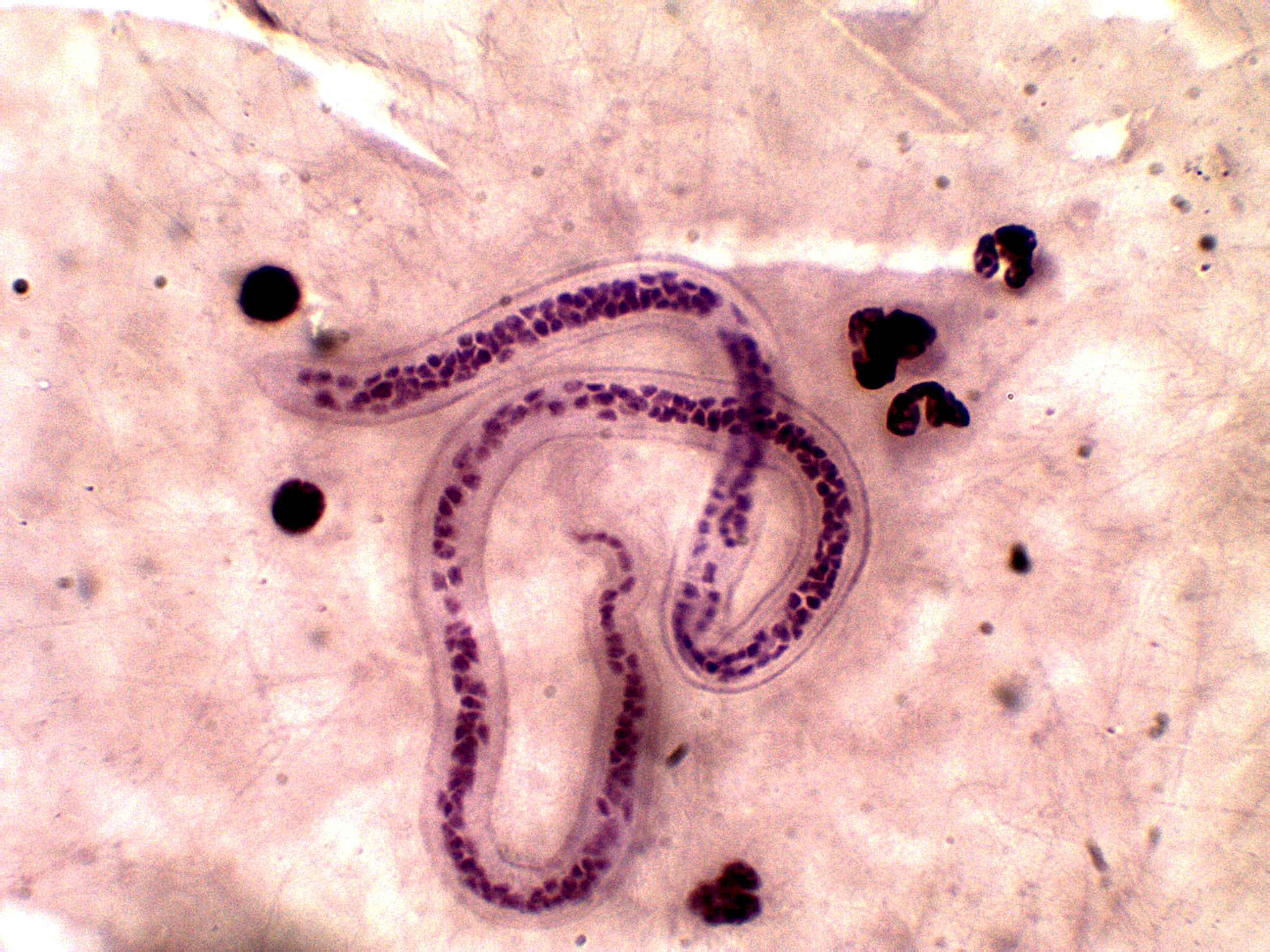 Wuchereria bancrofti – Parasitology