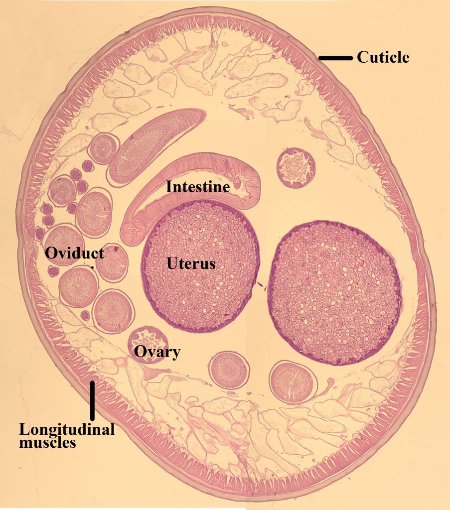 Ascaris lumbricoides – Female Cross Section – Parasitology Ascaris lumbricoides – Female Cross Section – Parasitology